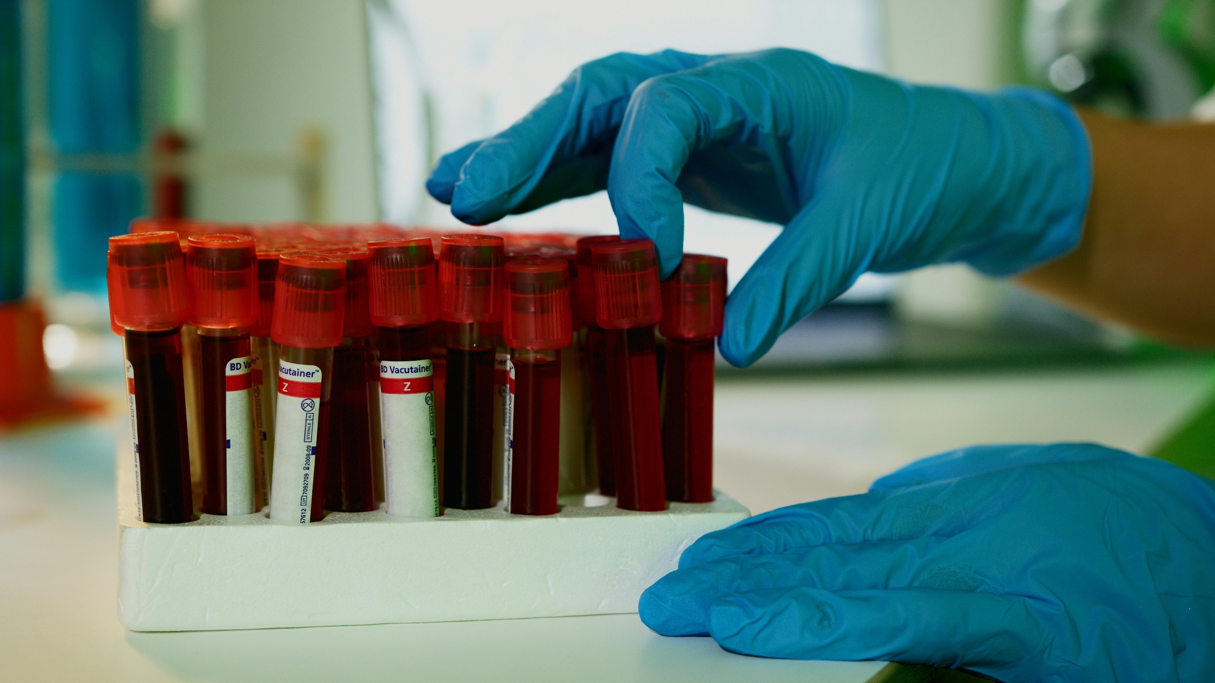 Demystifying Your Blood Profile - Fast Talk Laboratories